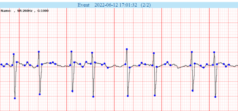 Polar H10 ECG Analysis - Biosignals Solutions Polar H10 ECG Analysis ...