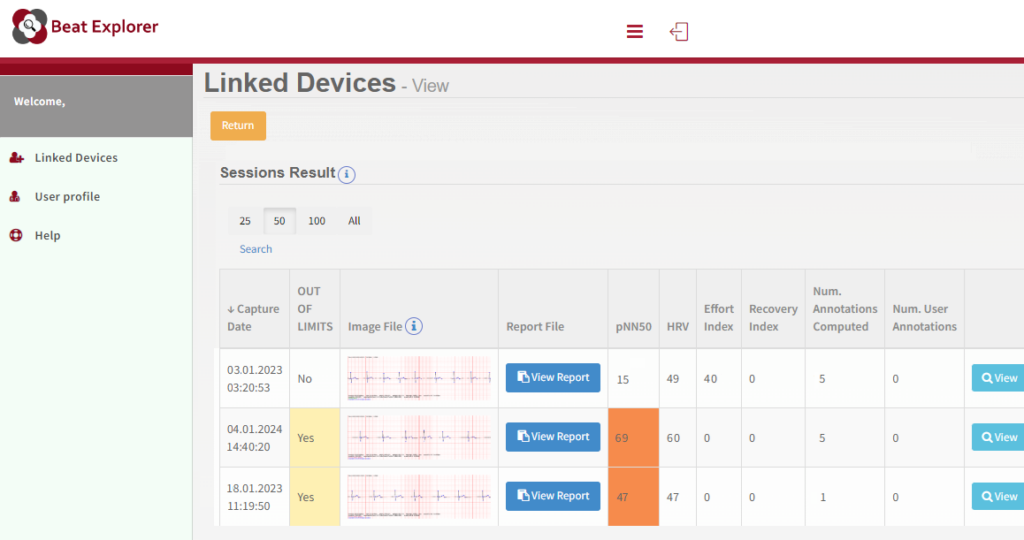 Beat Explorer web application - Biosignals Solutions