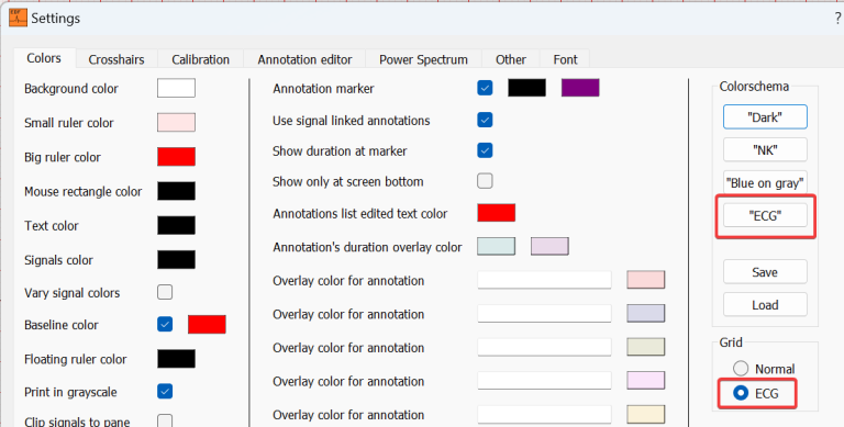 Polar ECG Analysis Help - Biosignals Solutions