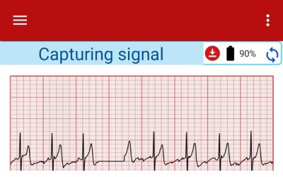 Polar ECG Analysis Help - Biosignals Solutions
